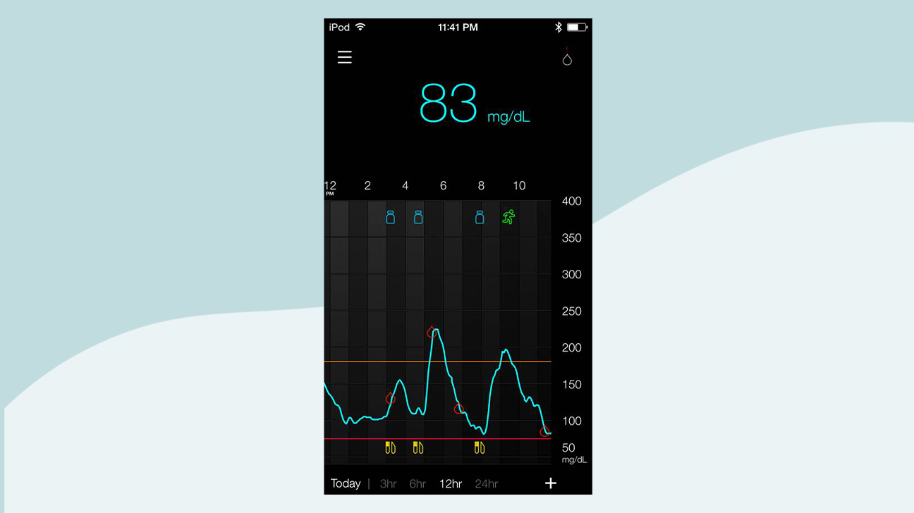 Medtronic lancia CGM stand-alone: Guardian Connect - Enciclopedia dello ...