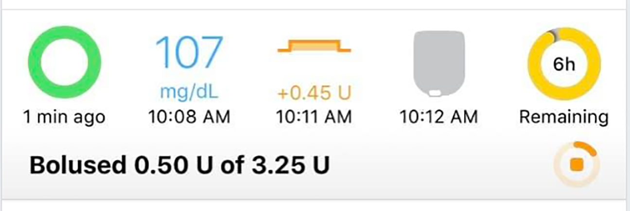 Diabetes Technology Review: New Do-It-Yourself Omnipod Loop