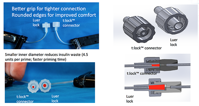 Tandem Diabetes Care: Staying Alive and Focused