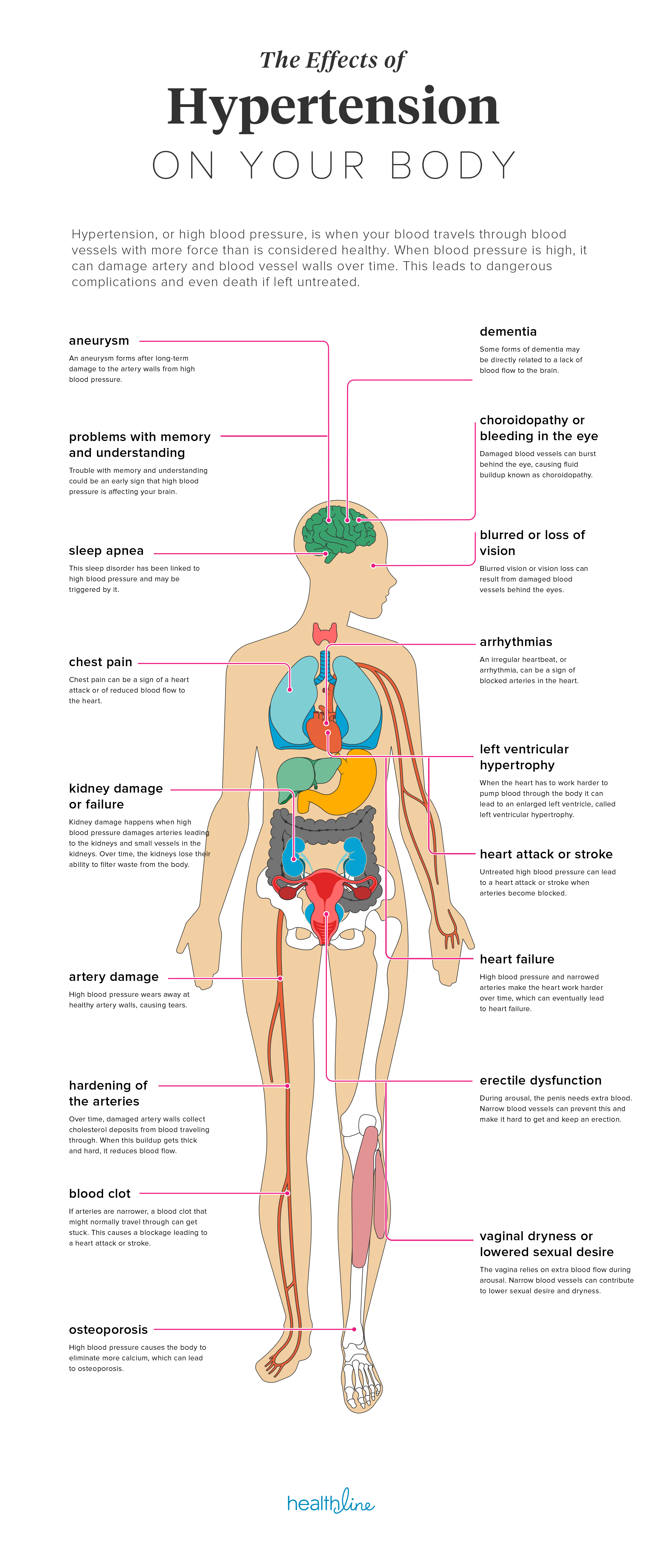 What Causes Your Blood Pressure To Be High What Your Blood Pressure 