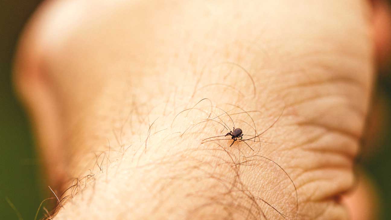 Lyme Disease: Painful, Long-Term Effects
