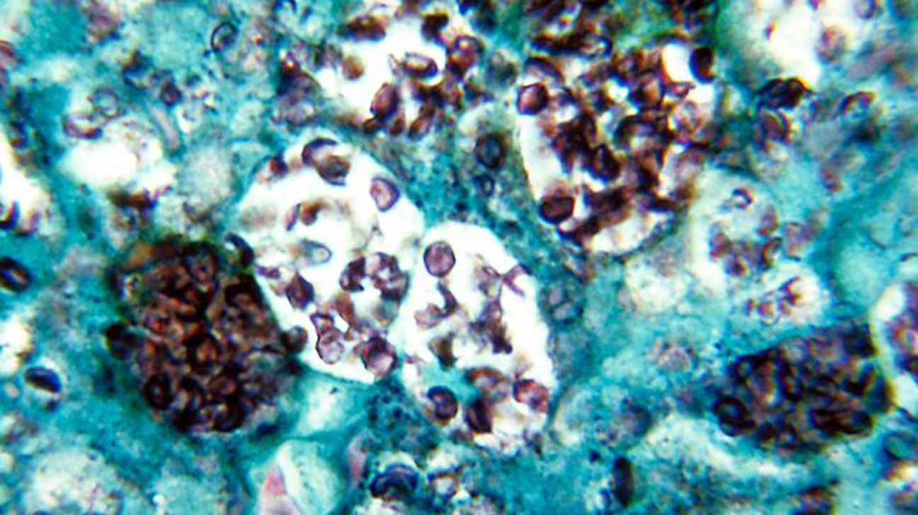 Cough and Rash: Causes, Photos, and Treatments