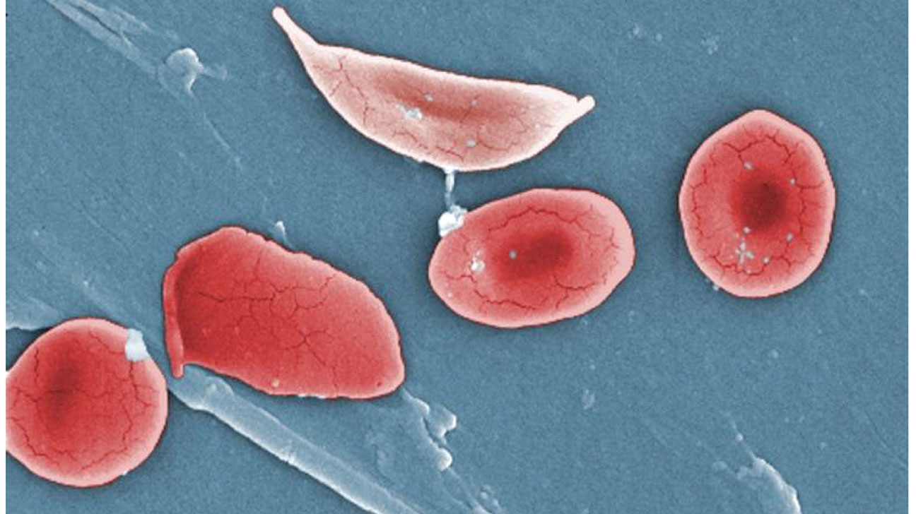 Blue Lips: Causes, Photos, and Treatments