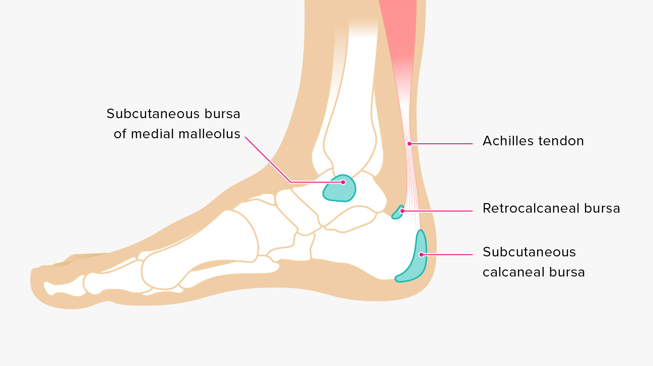 Bursitis Ankle Bursa Care And Prevention