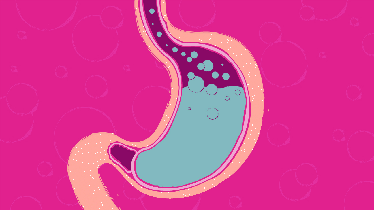 GERD: Facts, Statistics, and You