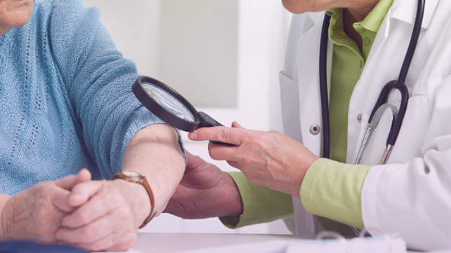 What’s Your Psoriasis Severity?