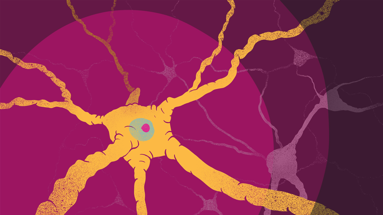 How Multiple Sclerosis Affects White and Gray Matter in the Brain
